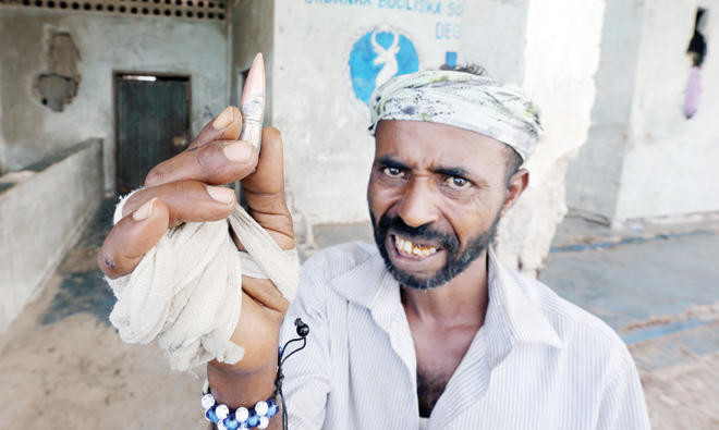 Somali forces accused of lacking clear lines of command and control ...
